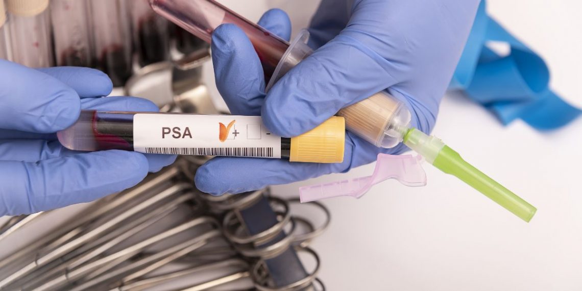 Explorando Valores Normais de PSA por Idade: Entendendo a Saúde ...